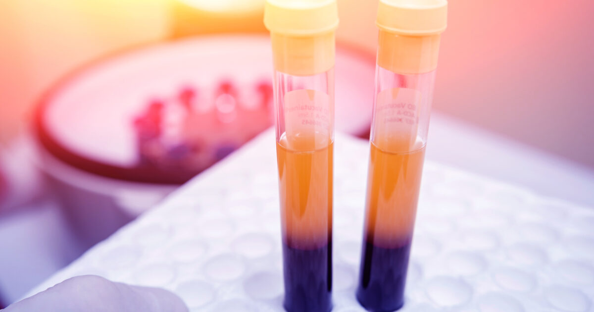 Discover How Evotec’s Industrialized Mass Spectrometry Platform Is Redefining Plasma Proteomics ...