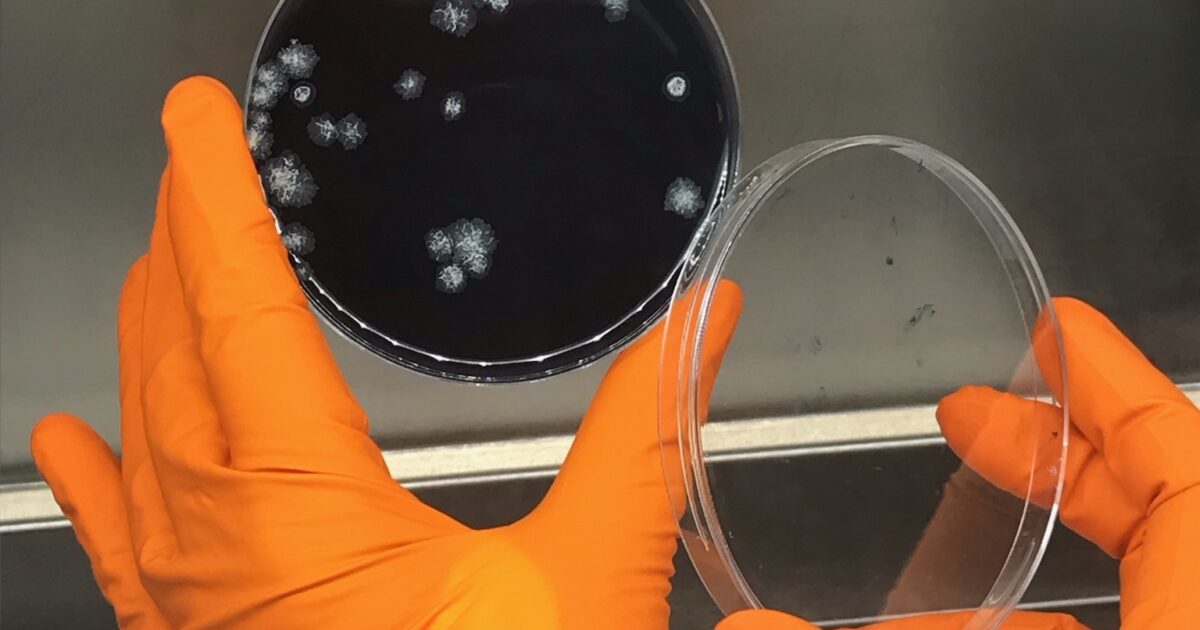 Advancing Preclinical Tuberculosis Research: An expert End-to-End TB ...