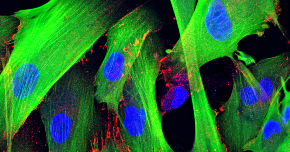 Mechanism of Action Characterization Using Cell Painting Techniques ...