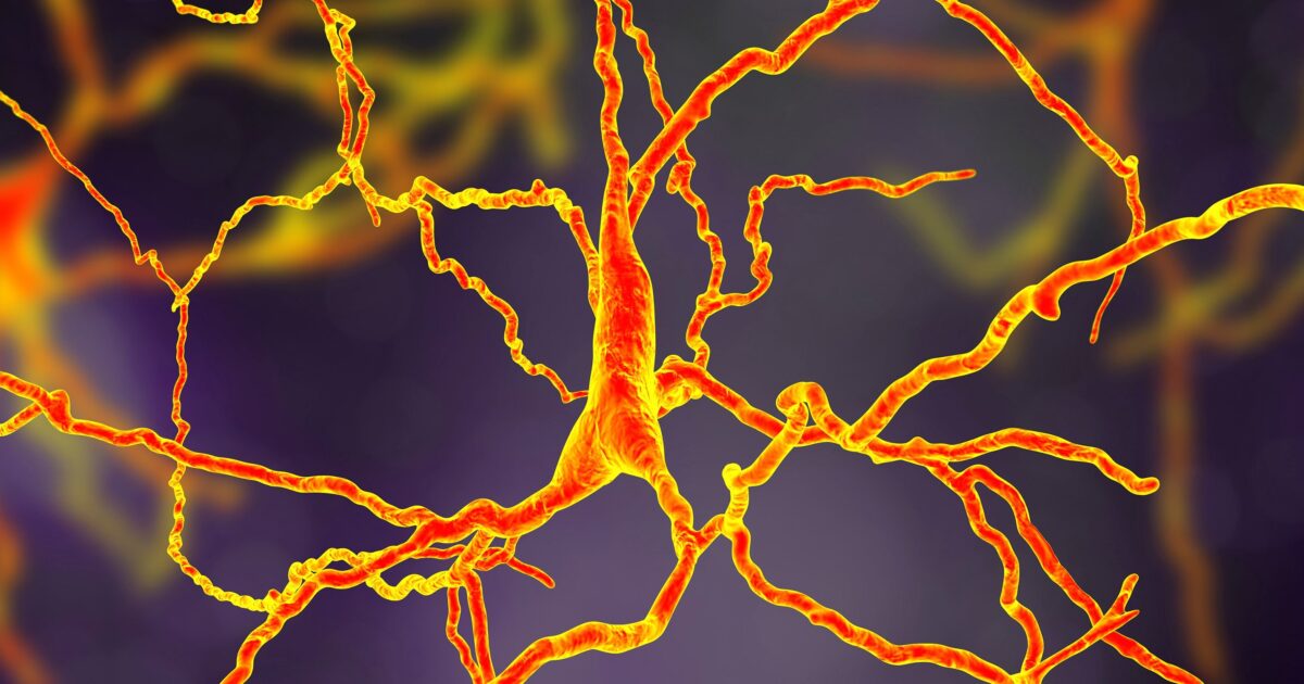 Choosing the Optimal Model for in vitro Neurotoxicity Assessment - Evotec