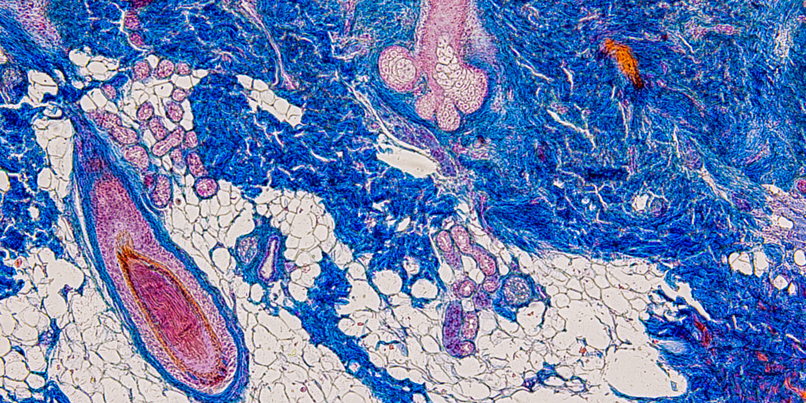 Direct Peptide Reactivity Assay (DPRA) | Cyprotex ADME-Tox Solutions ...