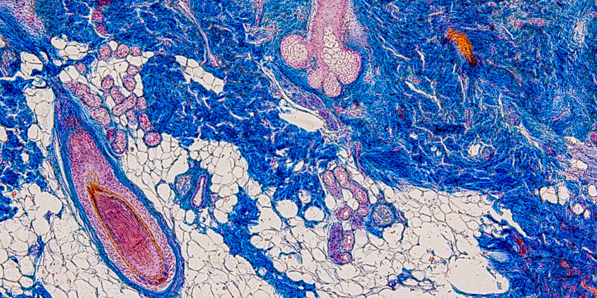 KeratinoSens™ Skin Sensitization | Cyprotex ADME-Tox Solutions - Evotec