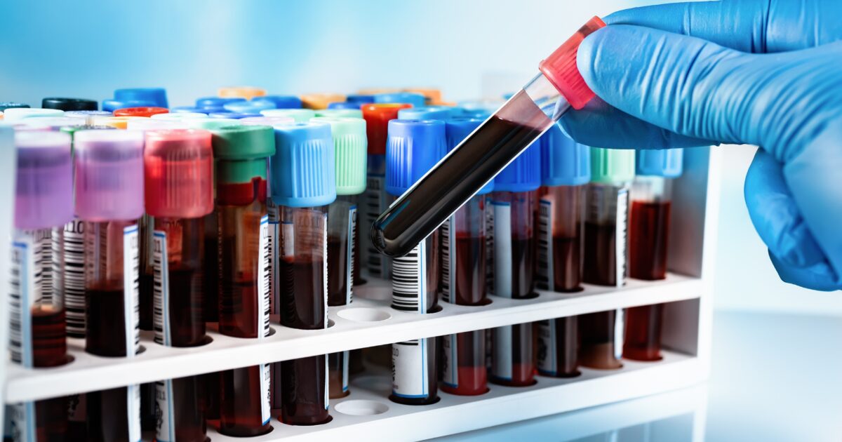 Human Sample Management | Evotec
