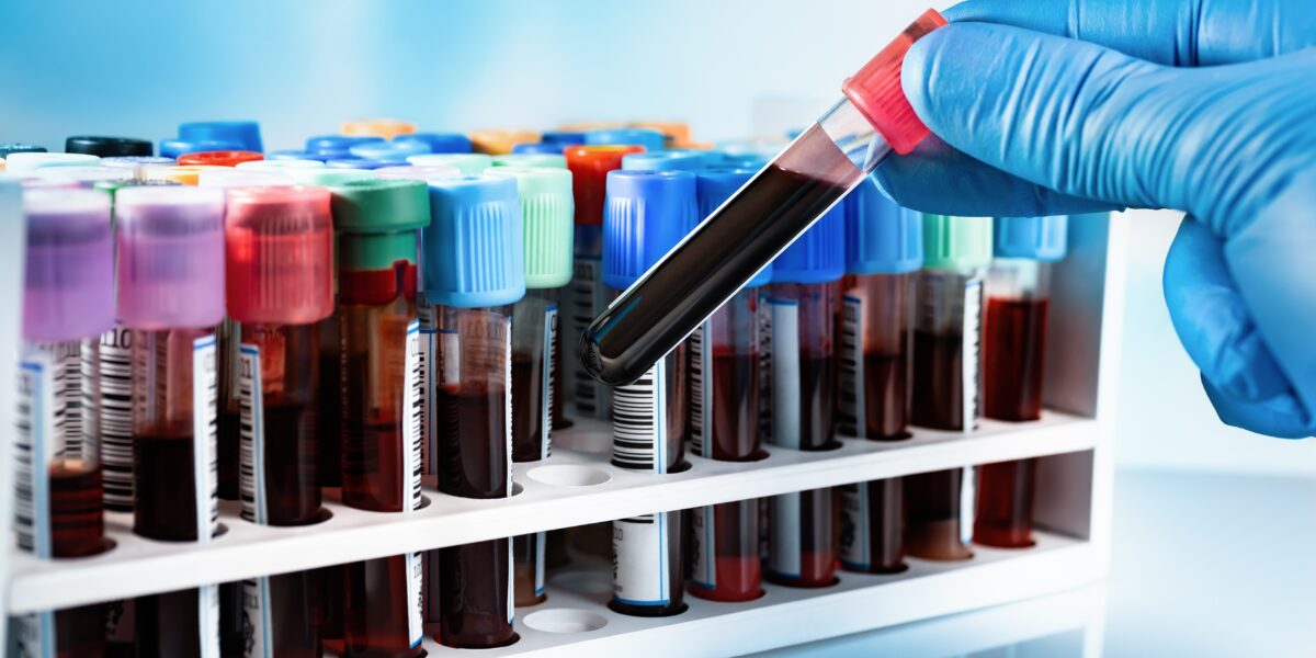 Human Sample Management | Evotec